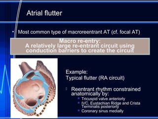 ECG approach to arrhythmias 2017 | PPT