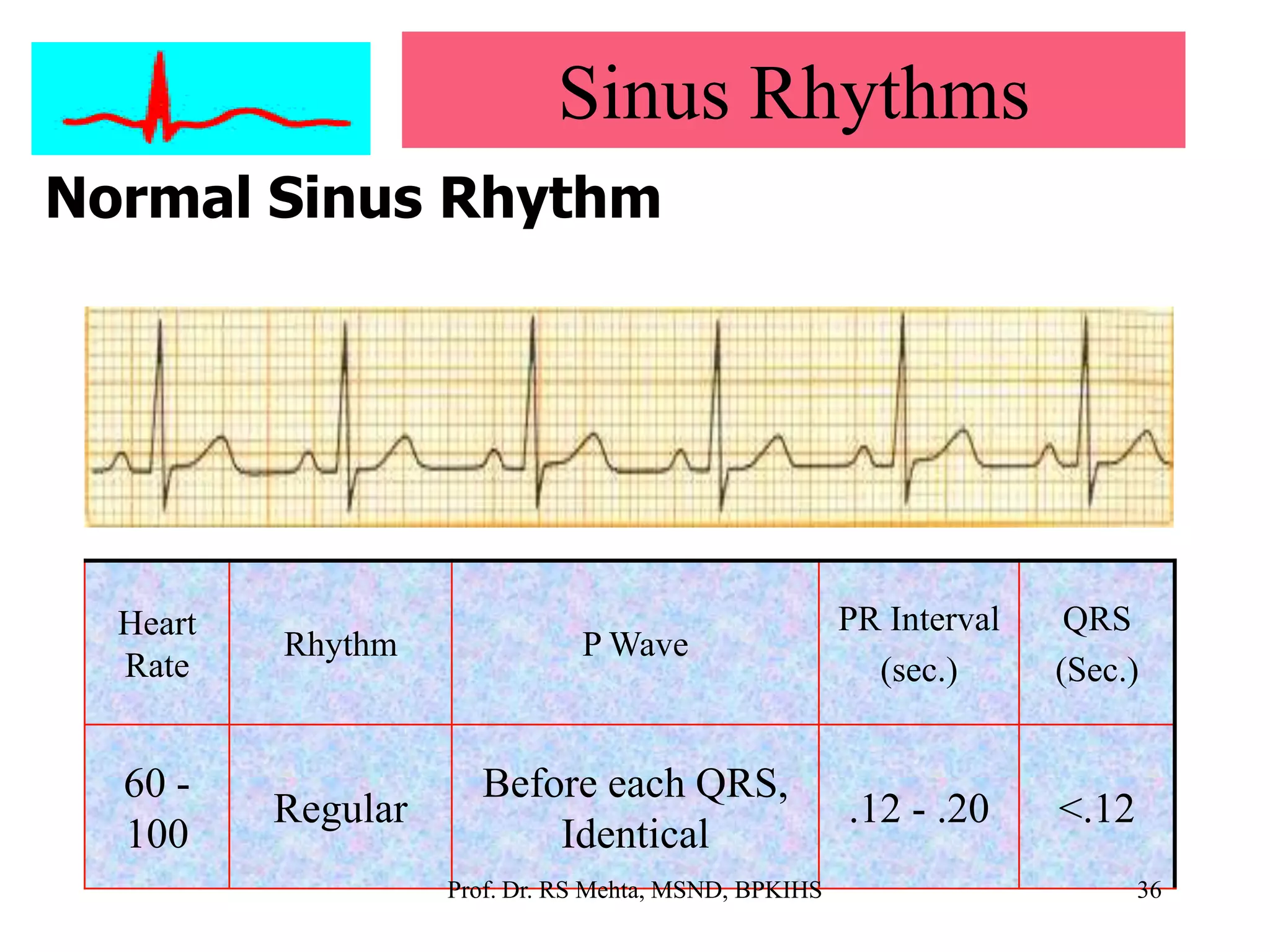 Ecg & arrhythmias | PPSX