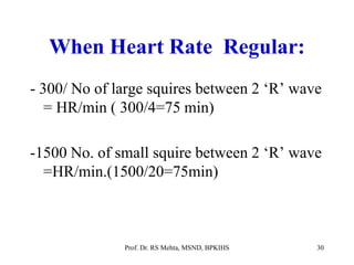 Ecg & arrhythmias | PPSX
