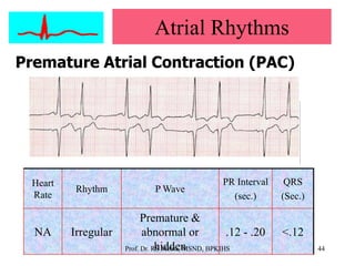Ecg & arrhythmias | PPSX