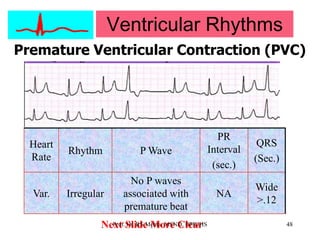 Ecg & arrhythmias | PPSX