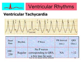 Ecg & arrhythmias | PPSX