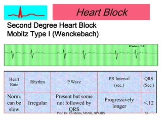 Ecg & arrhythmias | PPSX
