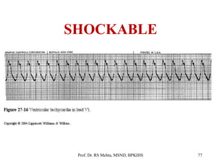 Ecg & arrhythmias | PPSX