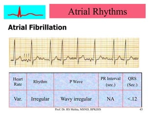 Ecg & arrhythmias | PPT