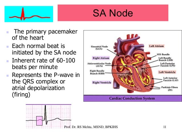 Ecg & arrhythmias