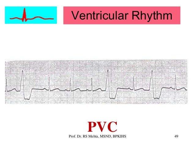 Ecg & arrhythmias