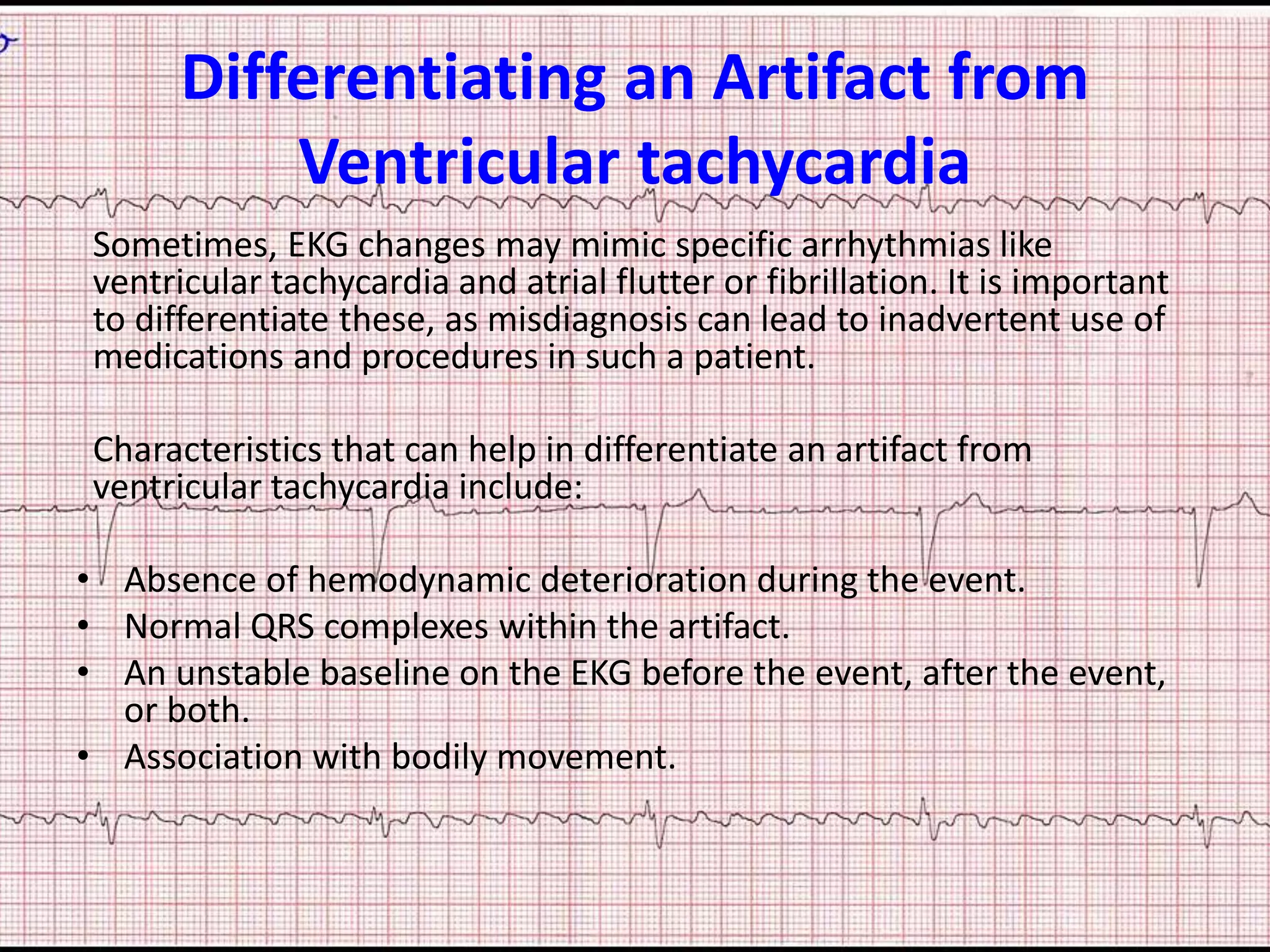 ECG ARTIFACTS AND PITFALLS | PPTX