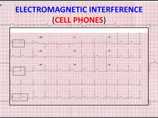 ECG ARTIFACTS AND PITFALLS | PPTX