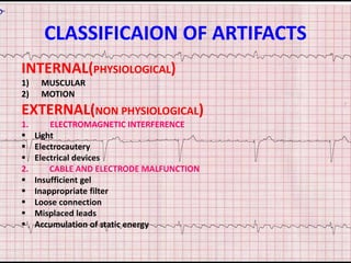 ECG ARTIFACTS AND PITFALLS | PPTX