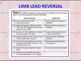 ECG ARTIFACTS AND PITFALLS | PPTX