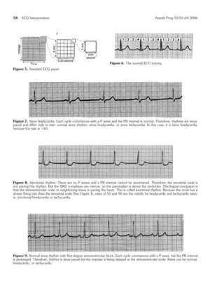 Ecg article | PDF