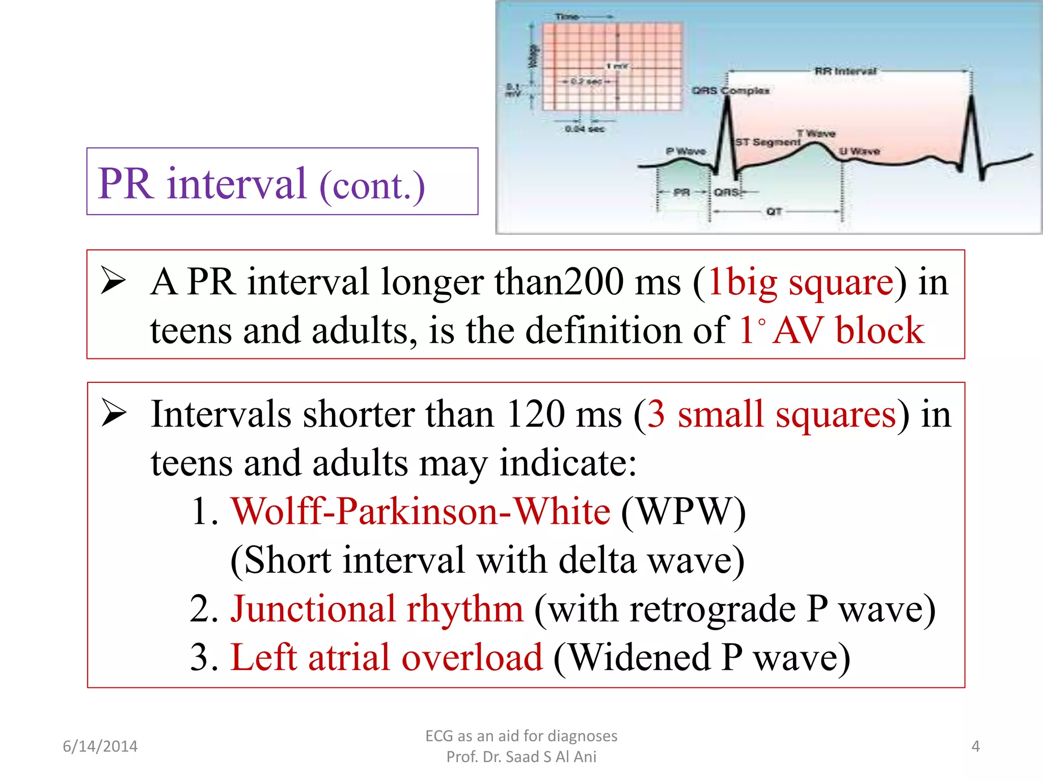 Ecg as an aid for diagnoses | PPTX