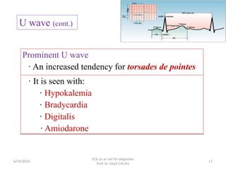 Ecg as an aid for diagnoses | PPTX