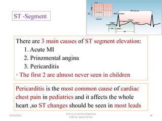 Ecg as an aid for diagnoses | PPTX
