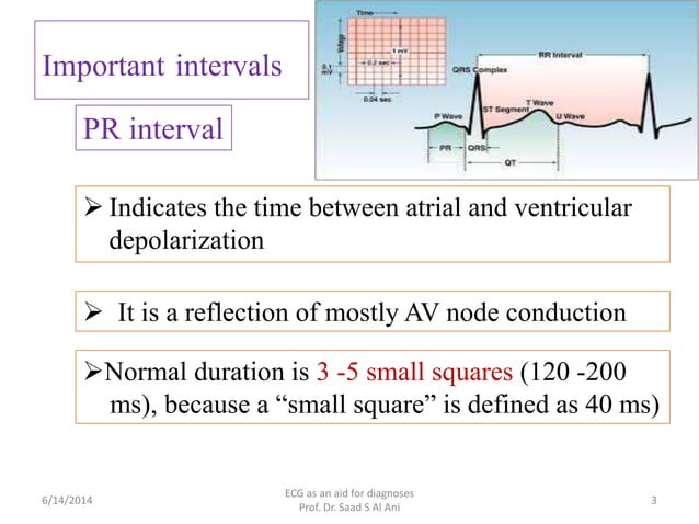 Ecg as an aid for diagnoses | PPT