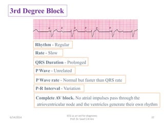 Ecg as an aid for diagnoses | PPTX