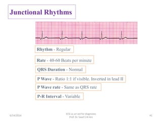 Ecg as an aid for diagnoses | PPTX