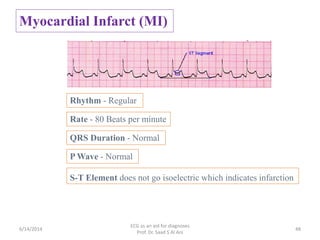 Ecg as an aid for diagnoses | PPTX