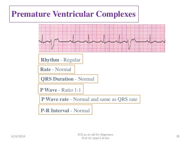 Ecg as an aid for diagnoses