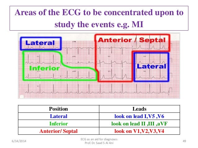 Ecg as an aid for diagnoses