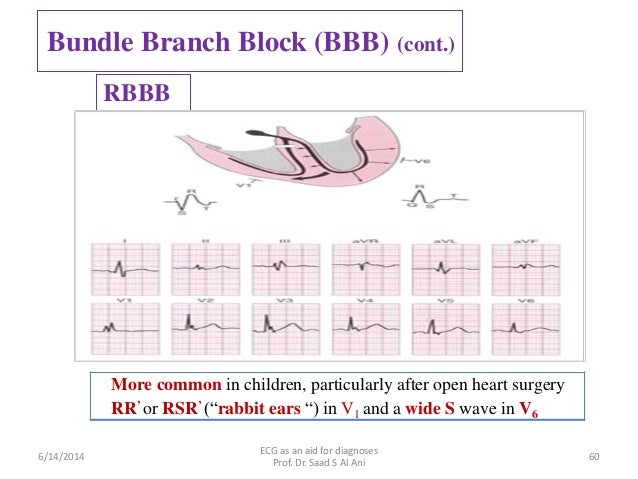 Ecg as an aid for diagnoses