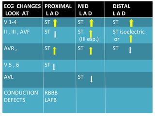 ECG: Interpreting ASMI | PPT
