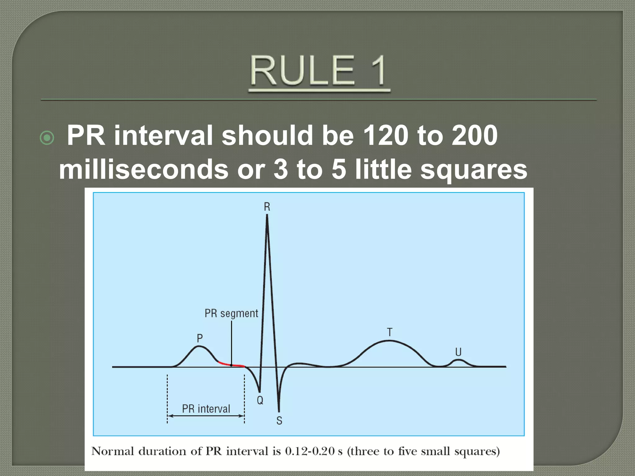 Ecg assessment of ihd | PPTX | Heart and Cardiovascular Diseases ...