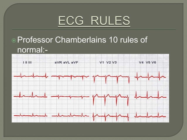 Ecg assessment of ihd | PPTX | Heart and Cardiovascular Diseases ...