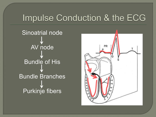 Ecg assessment of ihd | PPTX | Heart and Cardiovascular Diseases ...