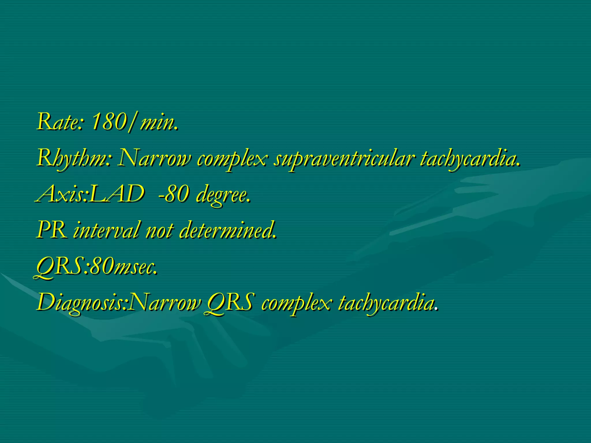 ECG - Narrow complex tachycardia | PPT