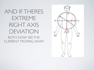 Ecg axis pdf | PDF