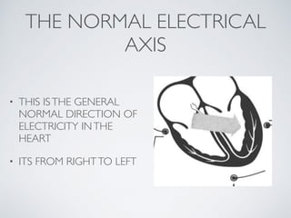 Ecg axis pdf | PDF