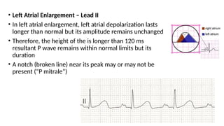 Introduction of ECG, or electrocardiogram | PPTX