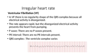 Introduction of ECG, or electrocardiogram | PPTX
