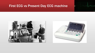 ECG(EKG) BASICS | PPTX
