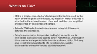 ECG(EKG) BASICS | PPT