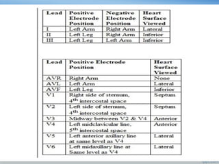 BASICS OF ECG | PPT