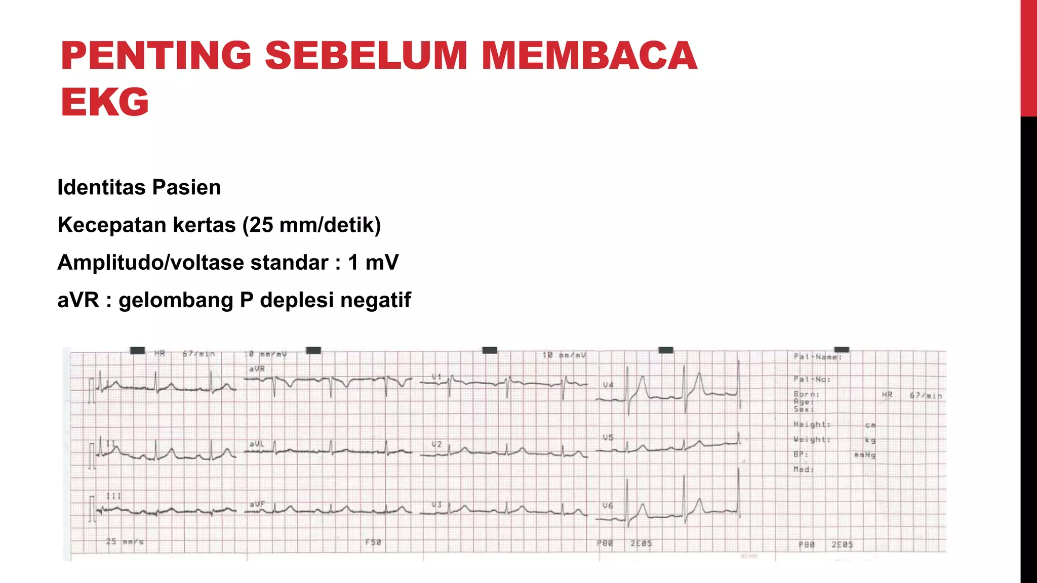 ECG Basic.pptx