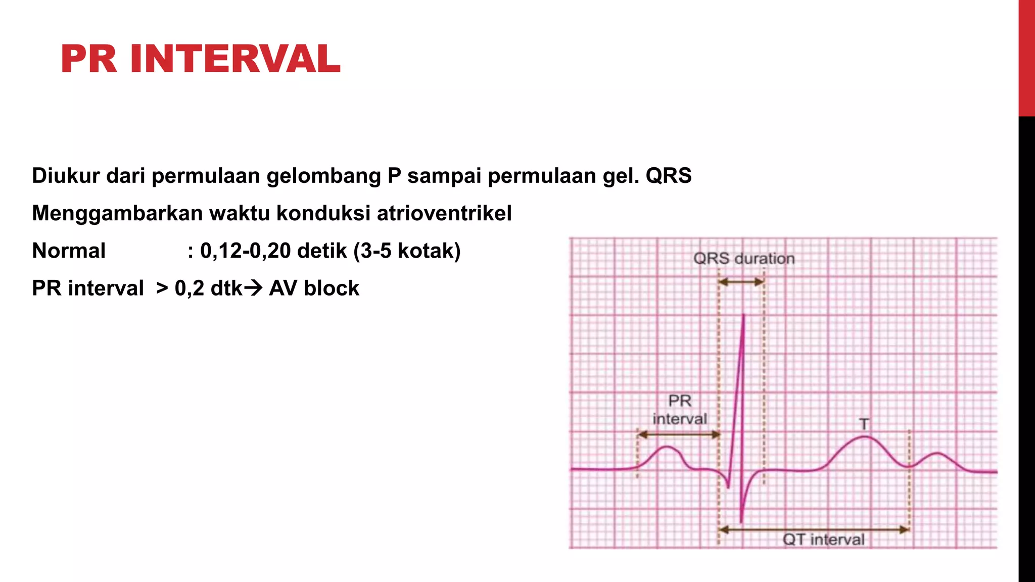 ECG Basic.pptx