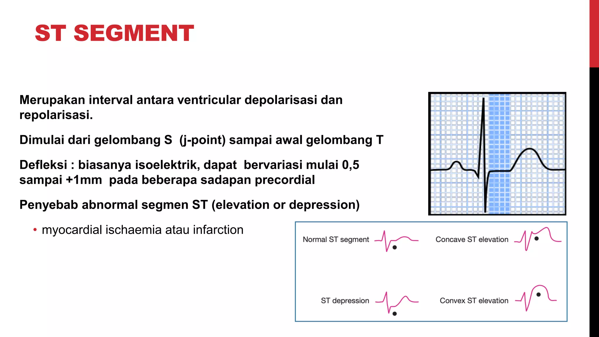 ECG Basic.pptx