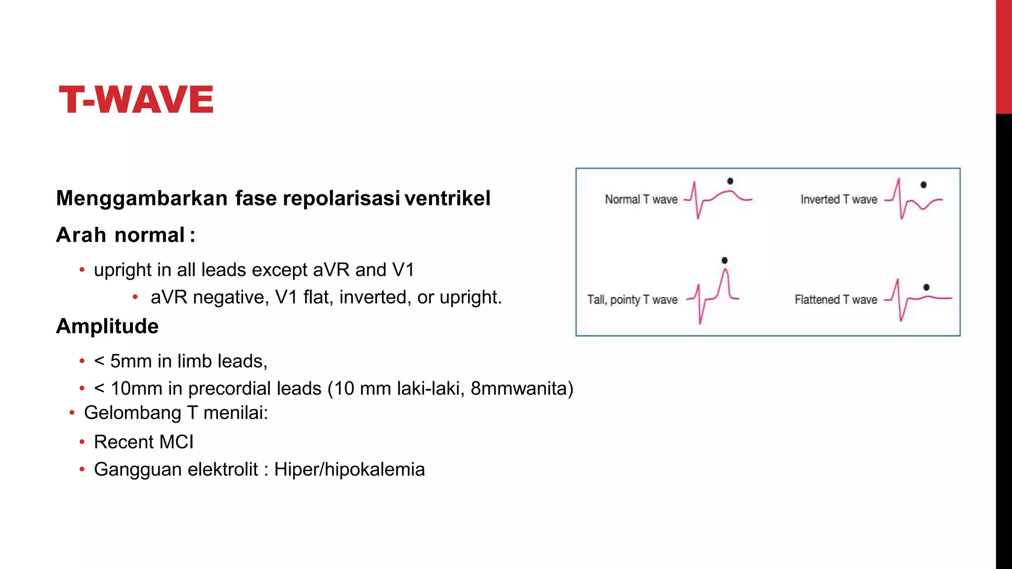 ECG Basic.pptx
