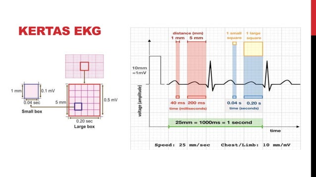 ECG Basic.pptx