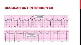 ECG Basic.pptx