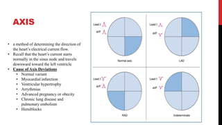 ECG Basic.pptx