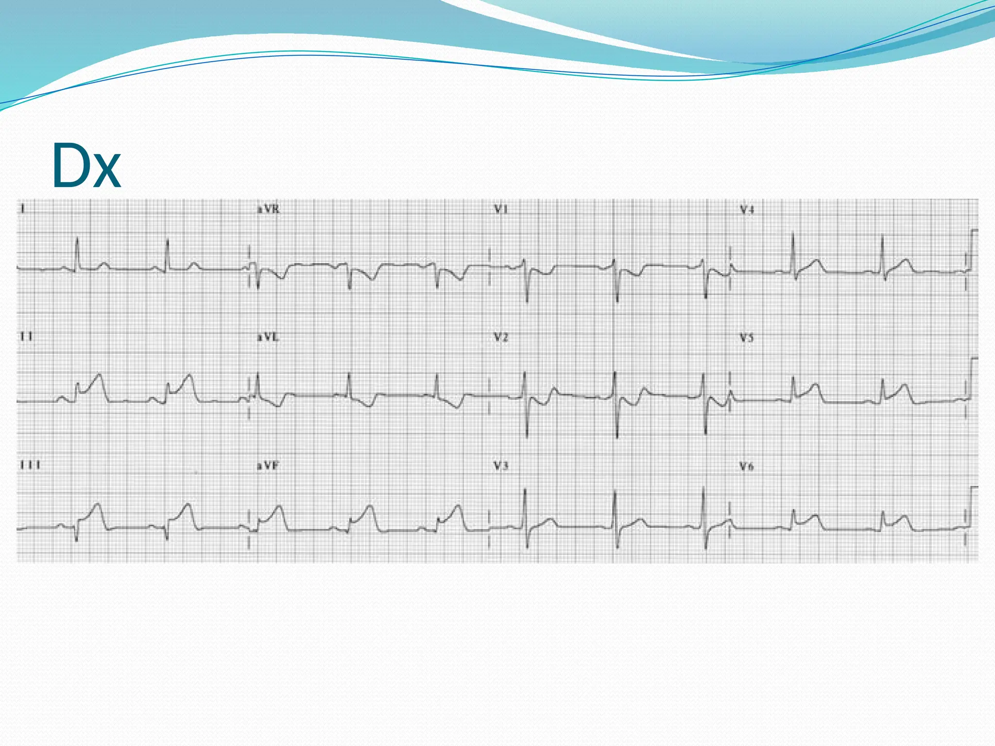ECG Basic.pptx, Dr. M.A. Sobuj Hayat, MBBS, BCS, D-Card(BSMMU) | PPTX
