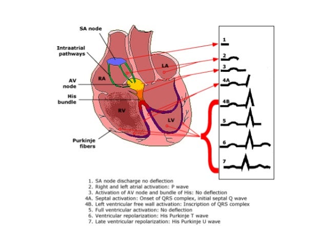 Electrocardiografía básica