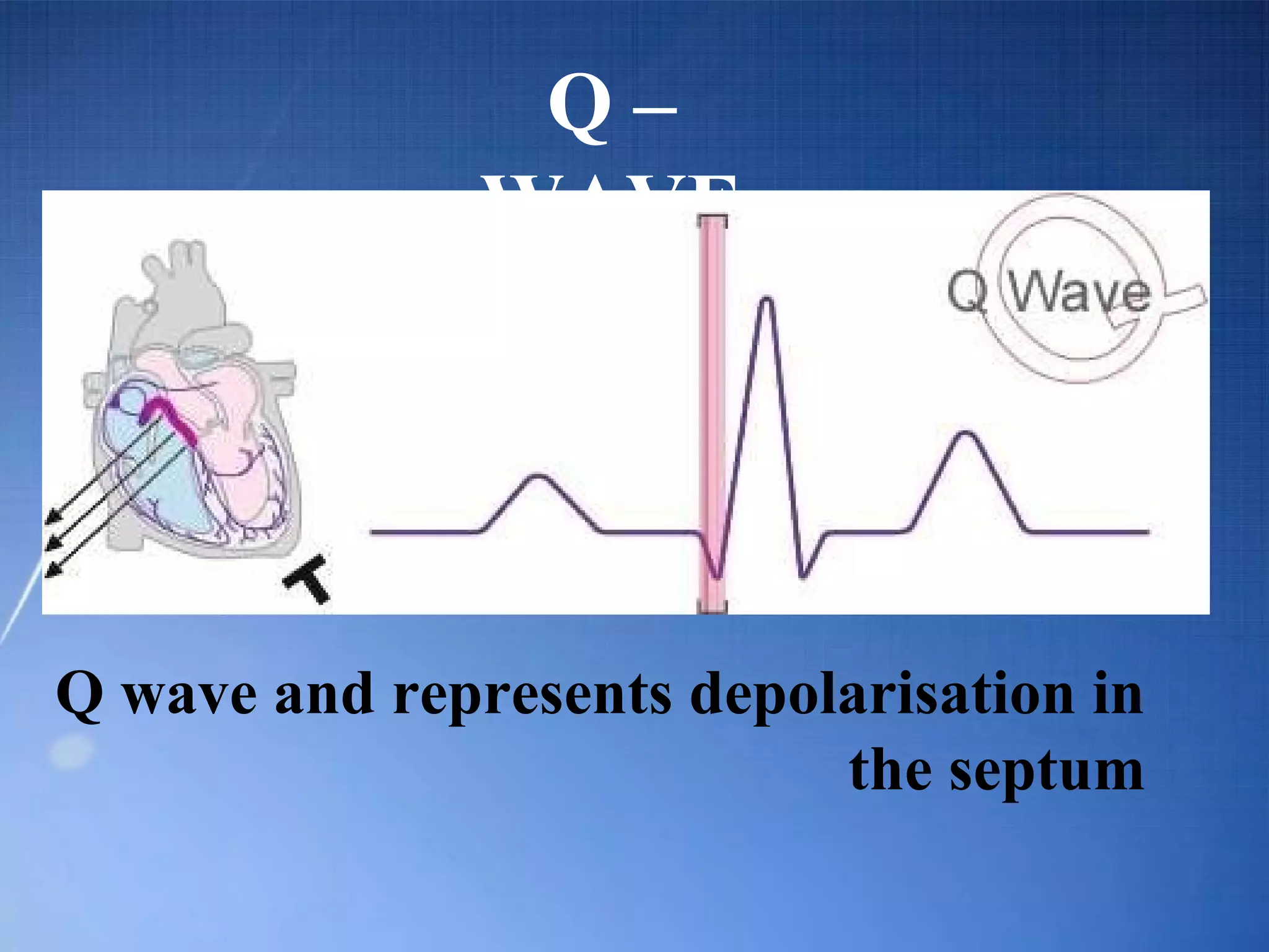 Ecg basic guidelines | PPT