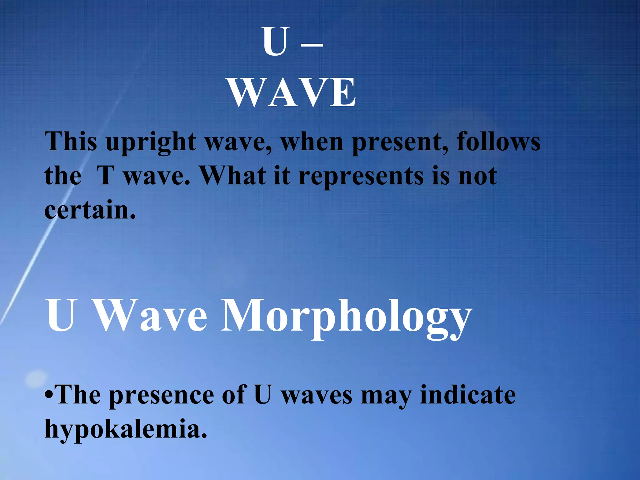 Ecg Basic Guidelines Ppt