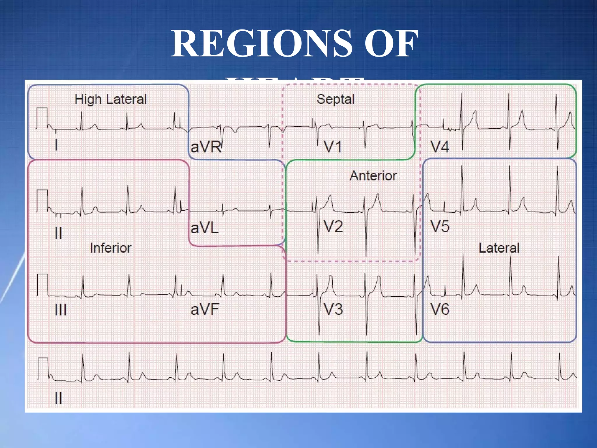 Ecg basic guidelines | PPT